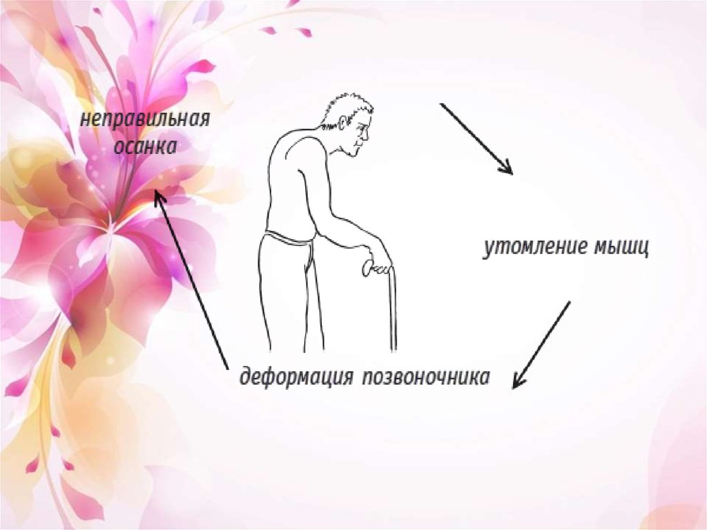 Позвоночник - презентация онлайн