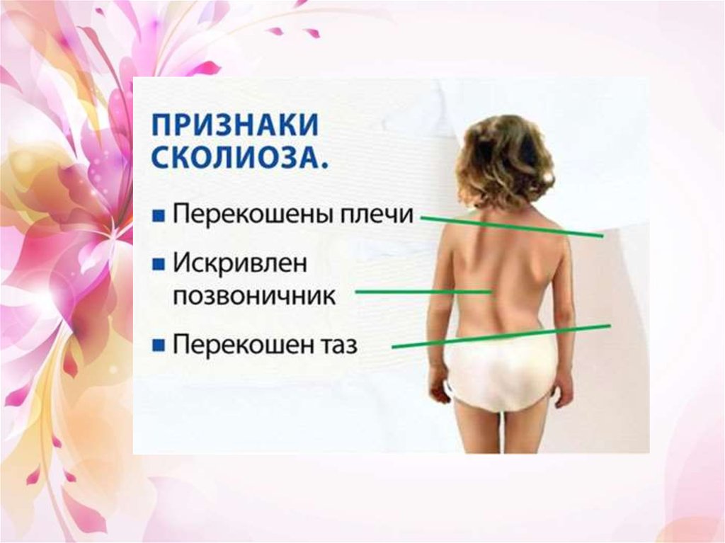 Позвоночник - презентация онлайн