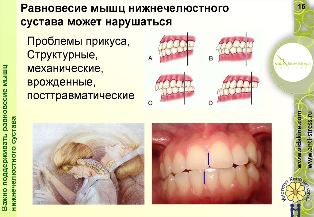 Нижнечелюстной сустав - презентация онлайн