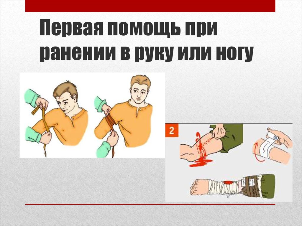 Первая помощь при ранении - презентация онлайн