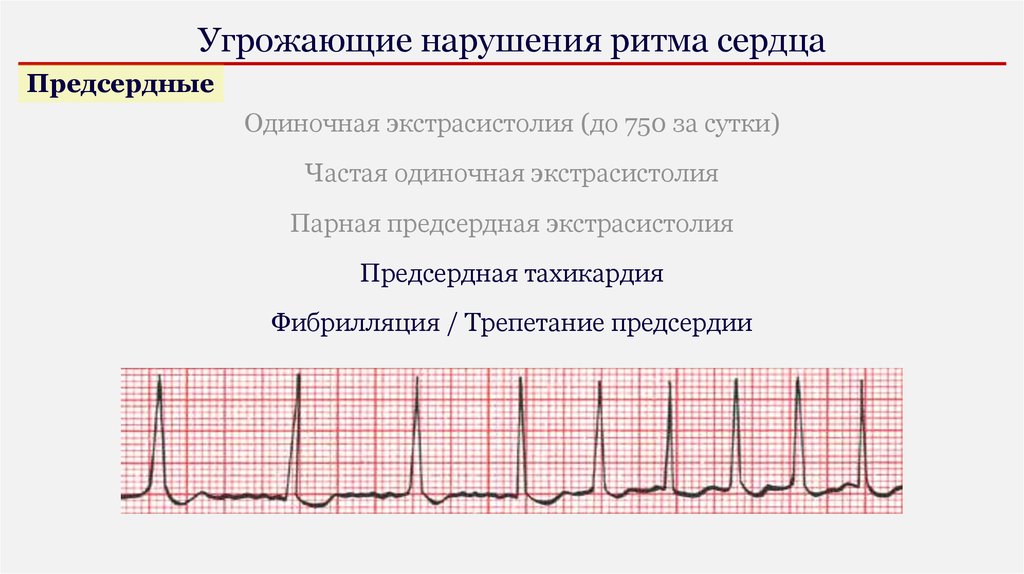 Ритм сердца: норма и патология - презентация онлайн
