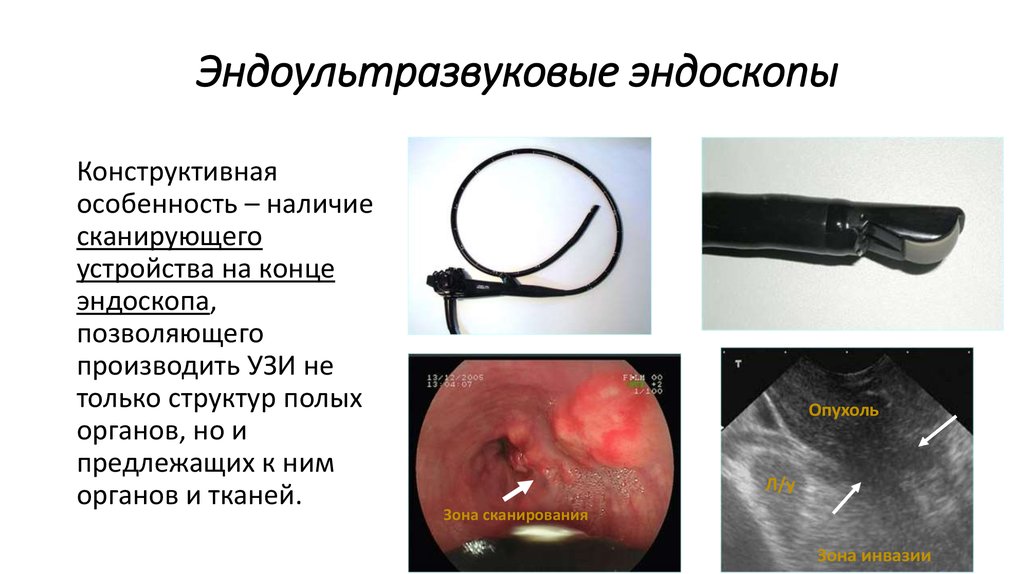 Osnovy_endoskopii - online presentation