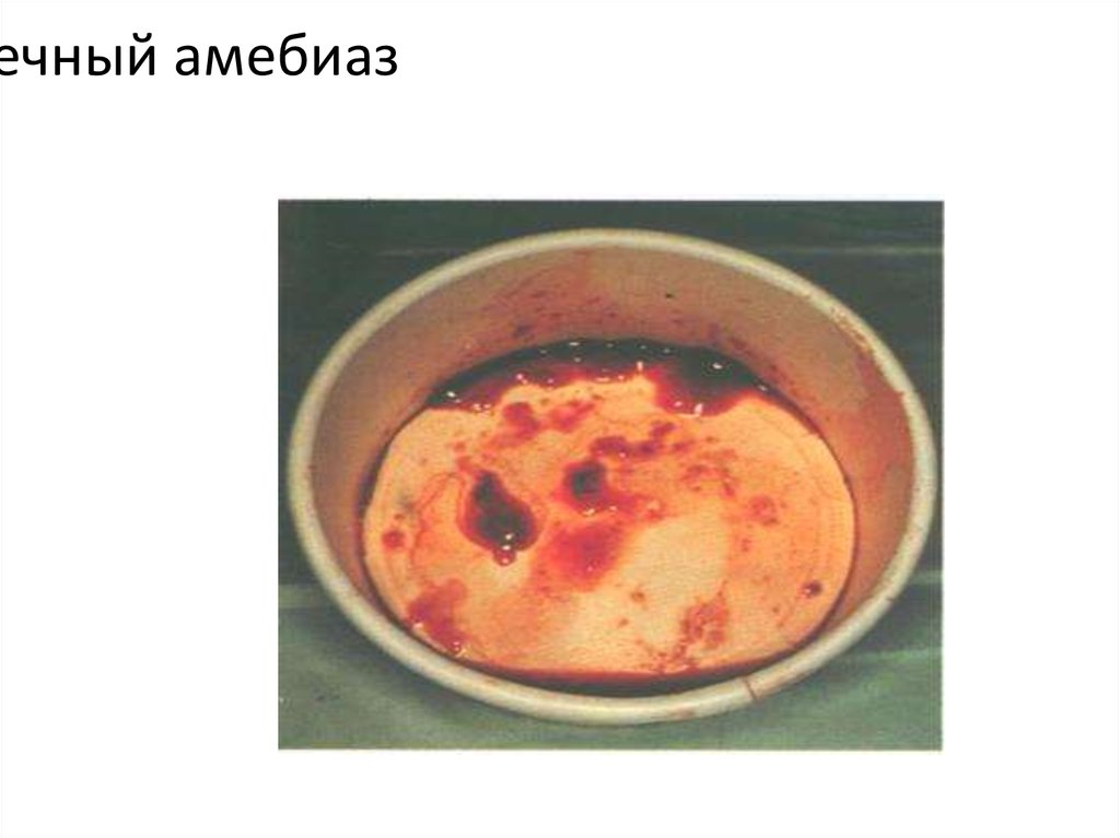 Сдача анализа кала - презентация онлайн