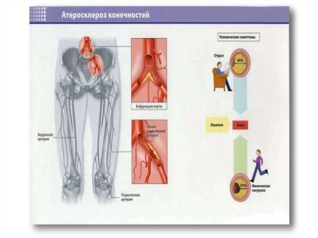 Профилактика атеросклероза - презентация онлайн