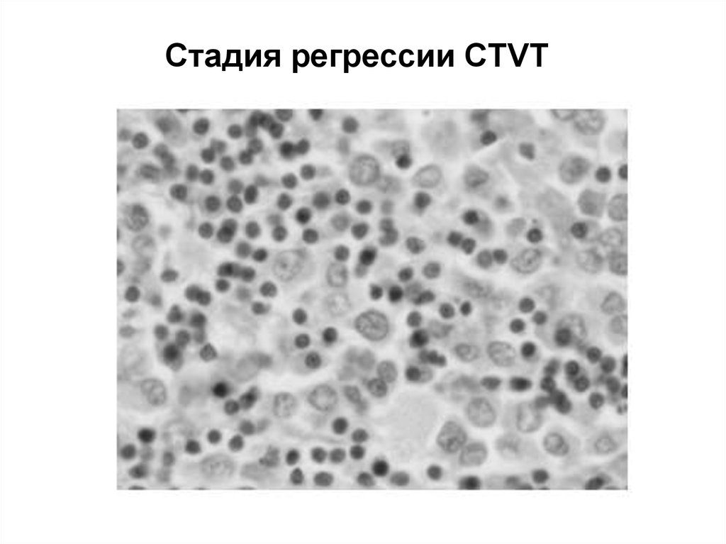 Трансплантационный иммунитет - online presentation